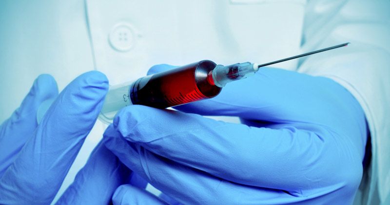 10 Blood Tests Every Indian Man Must Have