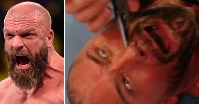 WrestleMania 35: Triple H Ripped Out Batistas Nose Ring With Pliers As ...