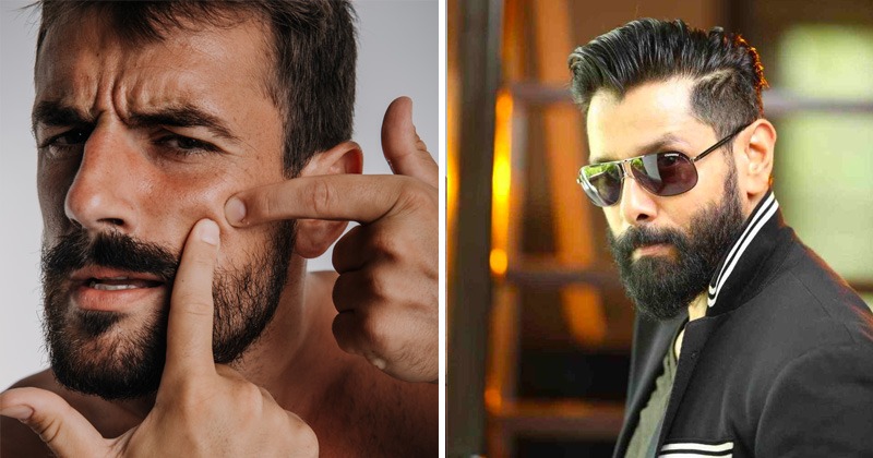 Beard Pimples: Causes & Treatment