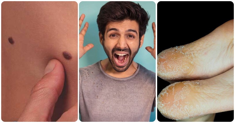 Gross Things That Are There On Your Body & How To Fix Them