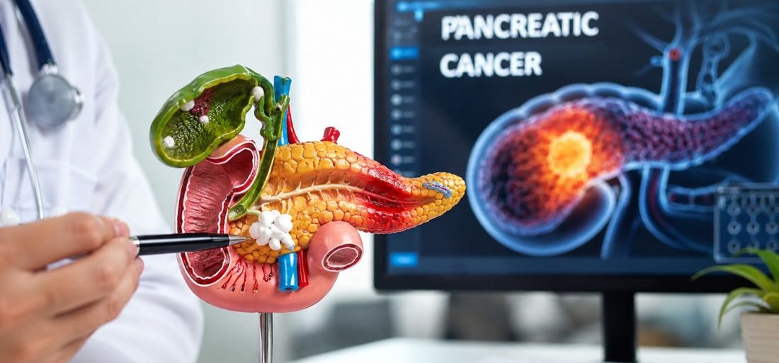 Pancreatic Cancer: Understanding the Disease, Its Symptoms, and ...